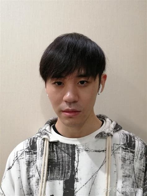 男生隆鼻要注意什么？ 知乎