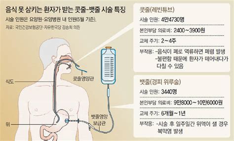 단독 뱃줄 놔둔채 콧줄 급식 4만명 고통
