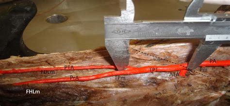 This Photograph Shows The Measurement Of The Tibioperoneal Trunk Is
