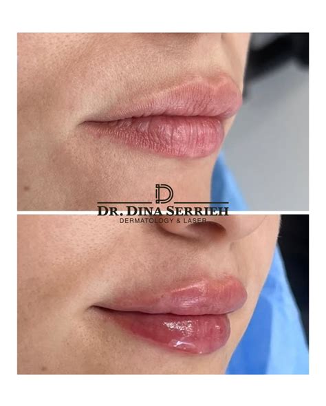 ‎dr Dina Serrieh الدكتورة دينا سرية‎ Rrieh • Instagram