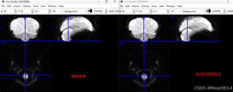 基于dpabi和spm12的脑脊液（csf）分割和提取笔记spm12分割 Csdn博客