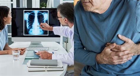 The Rare Inflammatory Condition That Is Sarcoidosis