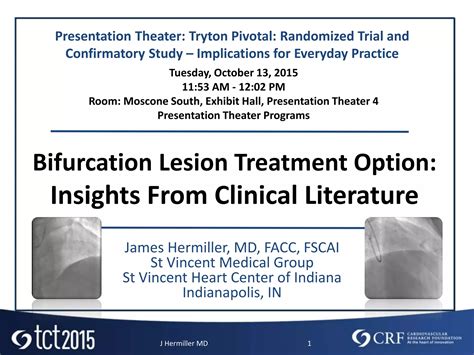 Bifurcation Lesion Treatment Option Insights From Clinical Literature