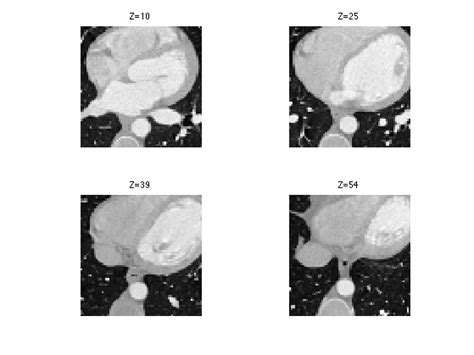 We Can Display An Isosurface Of The Dataset Here We Sub Sample To