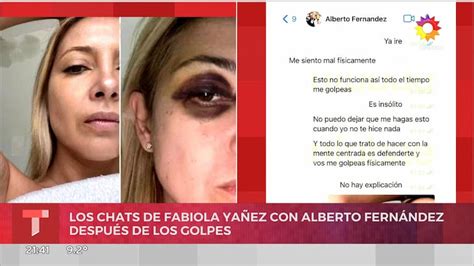 Las Fotos De Fabiola Yañez Golpeada Lo Venís Haciendo Hace Tres Días
