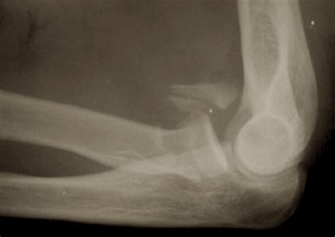 Thread By Ortho Reviews On Thread Reader App Thread Reader App