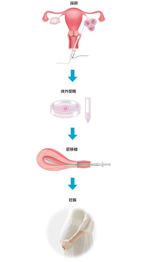 採卵・体外受精・顕微授精 東大病院 女性外科