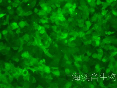 Hepa1 6 Gfp绿色荧光蛋白标记的小鼠肝癌细胞 企业官网