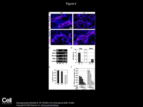 Schematic Presentation Of Osteoblast And Osteoclast
