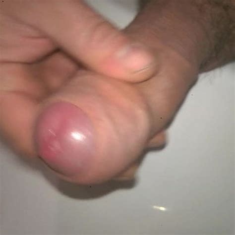Bite Veineuse Non Coupée Xhamster