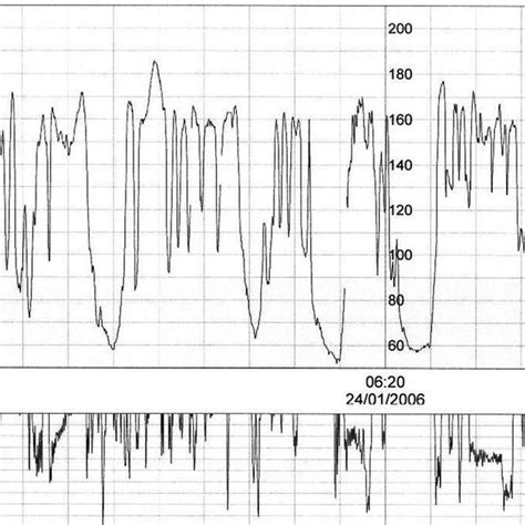 Nice Ctg Classification Download Table