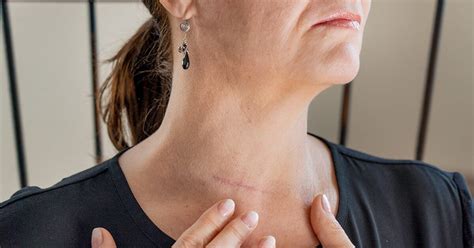 Thyroid Cancer Surgery Thyroidectomy Lobectomy And More