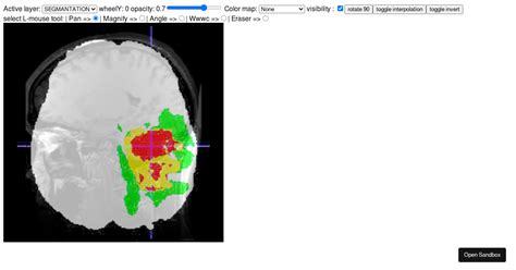 Cornerstone React Example Codesandbox