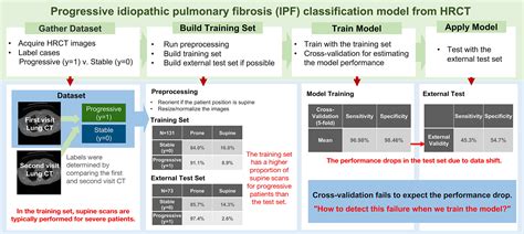 Translating Ai To Clinical Practice Overcoming Data Shift With Explainability Radiographics