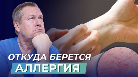 ВАМ МСТИТ ВАШ КИШЕЧНИК Узнайте как БЫСТРО ВЫЛЕЧИТЬ АЛЛЕРГИЮ Youtube