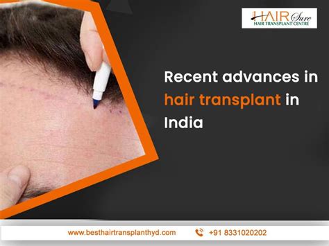 Recent Advances In Hair Transplant In India Cyber Hairsure