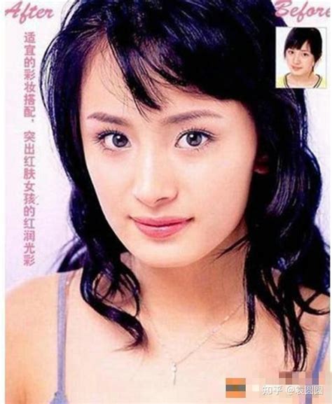 什么情况下正畸拔牙会变瘪嘴？ 知乎