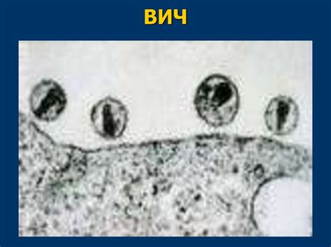 Вирус иммунодефицита человека презентация онлайн