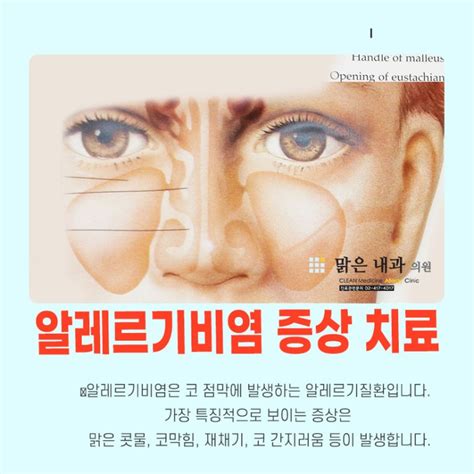 알레르기비염 콧물 코막힘 치료 천식 증상 확인해봐야 네이버 블로그