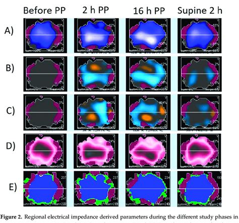 Regional Electrical Impedance Derived Parameters During The Different Download Scientific