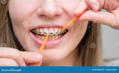 Unrecognizable Caucasian Woman Cleans Braces With A Brush Close Up Of Female Teeth With