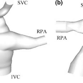 Geometries Of The Two TCPC Anatomies Retained For This Study A Model Download Scientific