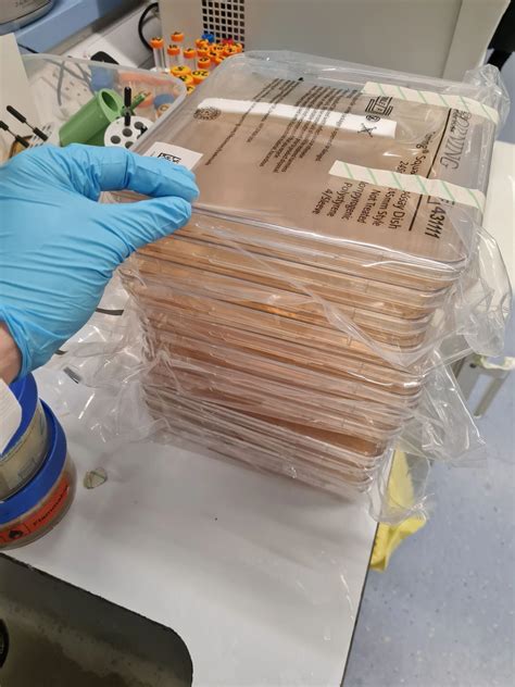 Zack Saud On Linkedin Nanobody Phage Display Library Build Its Been A Minute