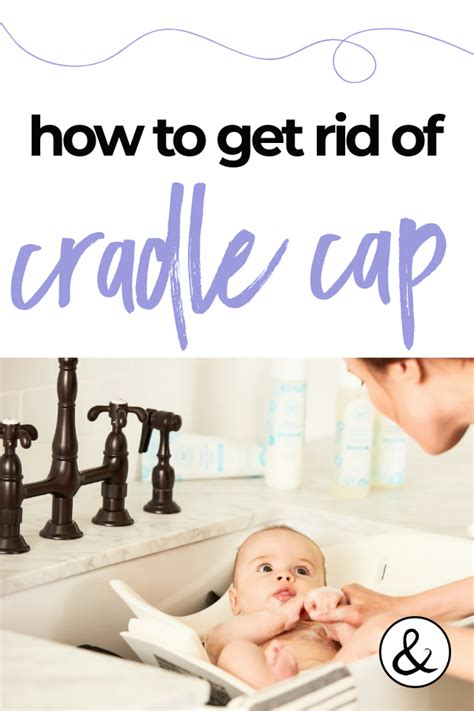 How To Get Rid Of Cradle Cap With One Simple Natural Remedy