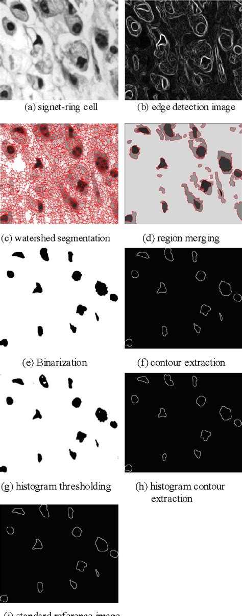 Table 1 From Cell Image Segmentation Based On An Improved Watershed Transformation Semantic
