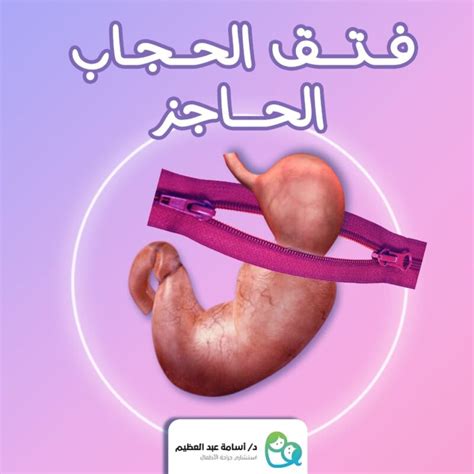 ماهو الفتق الحجابي عند الاطفال ؟ د أسامة عبد العظيم