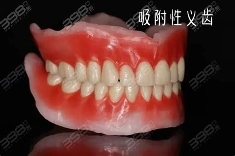 吸附性义齿和普通义齿有啥区别？看图片了解吸附性义齿的优缺点和价格 口腔医院新闻 398口腔网