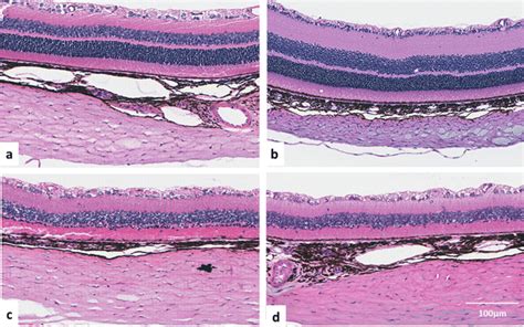 Photoreceptor Degeneration In Immunodeficient Rcs Rats Evaluated Based