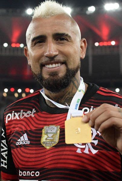 Arturo Vidal Campeón En Flamengo Le Muestra Su Pierna Lesionada A
