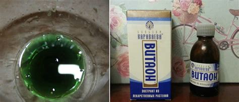 Раствор «Хлорофиллипта»