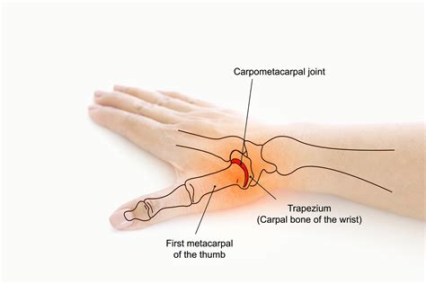 Carpometacarpal Joint Anatomy