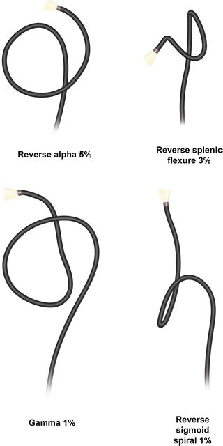 Anatomic Basis Of Colonoscopy Abdominal Key