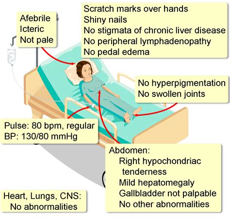 Primary Biliary Cholangitis Interactive Case Study Clinical Odyssey By Medical Joyworks LLC