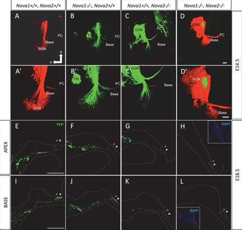 Figures And Data In Nova2 Mediated Rna Regulation Is Required For Axonal Pathfinding During