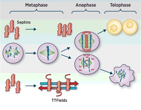 Tumor Treating Fields Creative Diagnostics