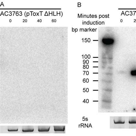 Northern Blots Of Tara And Tarb 32 P Utp Labeled Riboprobes