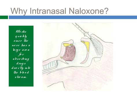 Naloxone Pilot Intranasaladminpresentation Ppt