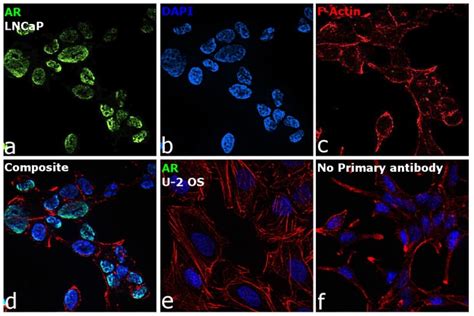 Androgen Receptor Recombinant Rabbit Monoclonal Antibody Arc0090