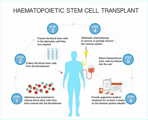 Hematopoietic Stem Cell Transplantation