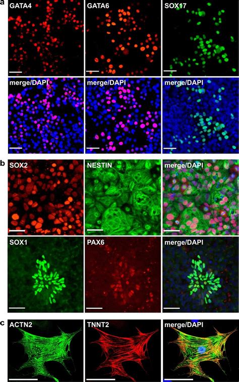 Three Germ Layer Differentiation Potential Of Nwr Ipscs See Also