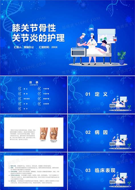 膝关节骨性关节炎的护理医疗查房ppt模板免费下载编号zqqcqmnjz图精灵