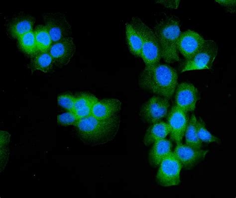 Aldolasealdoa Antibody