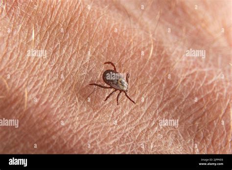 Crawling Deer Tick On The Background Of Human Hairy Skin Dangerous