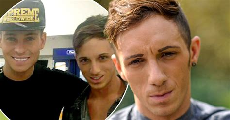 Joey Essex Wannabe Begs Nhs To Reverse £50000 Plastic Surgery Now I