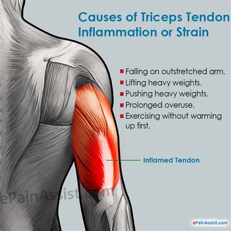 Triceps Tendon Anatomy Young Muscular Man Character Standing Showing