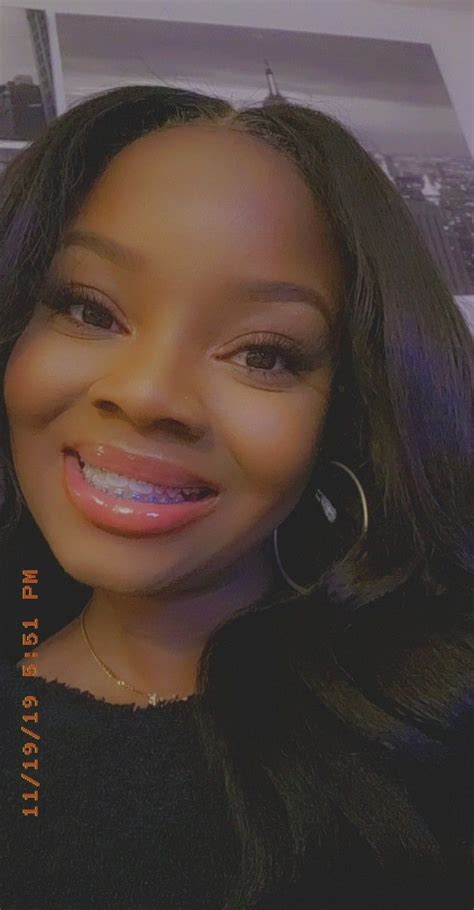 Braces Black Women With Braces Brace Face Black Women Braces Colors